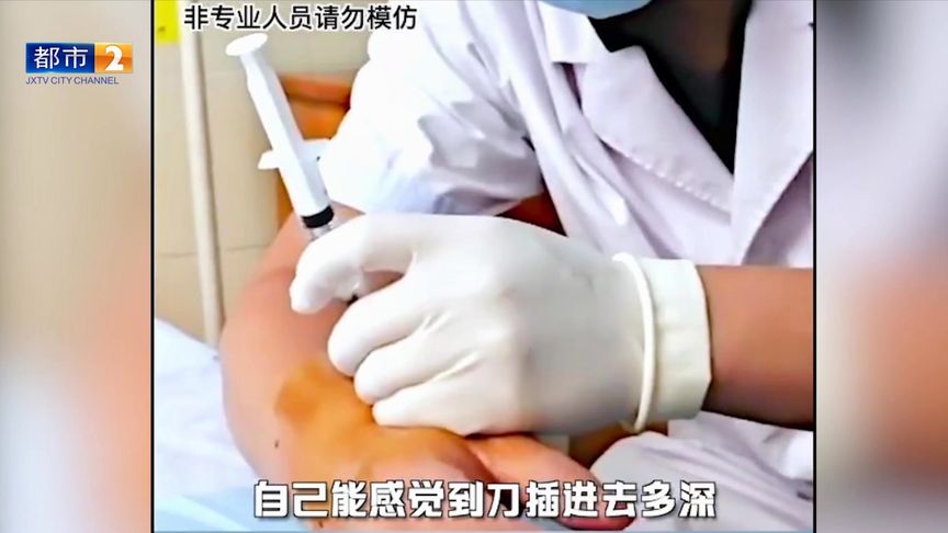 拿自己开刀!骨科医生左手给右手做手术 真下得去手!