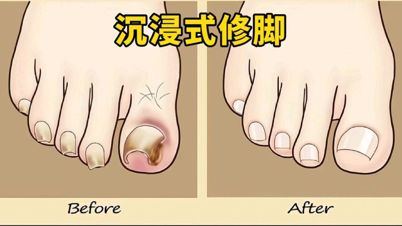 解压动画短片:沉浸式修脚,超级解压!