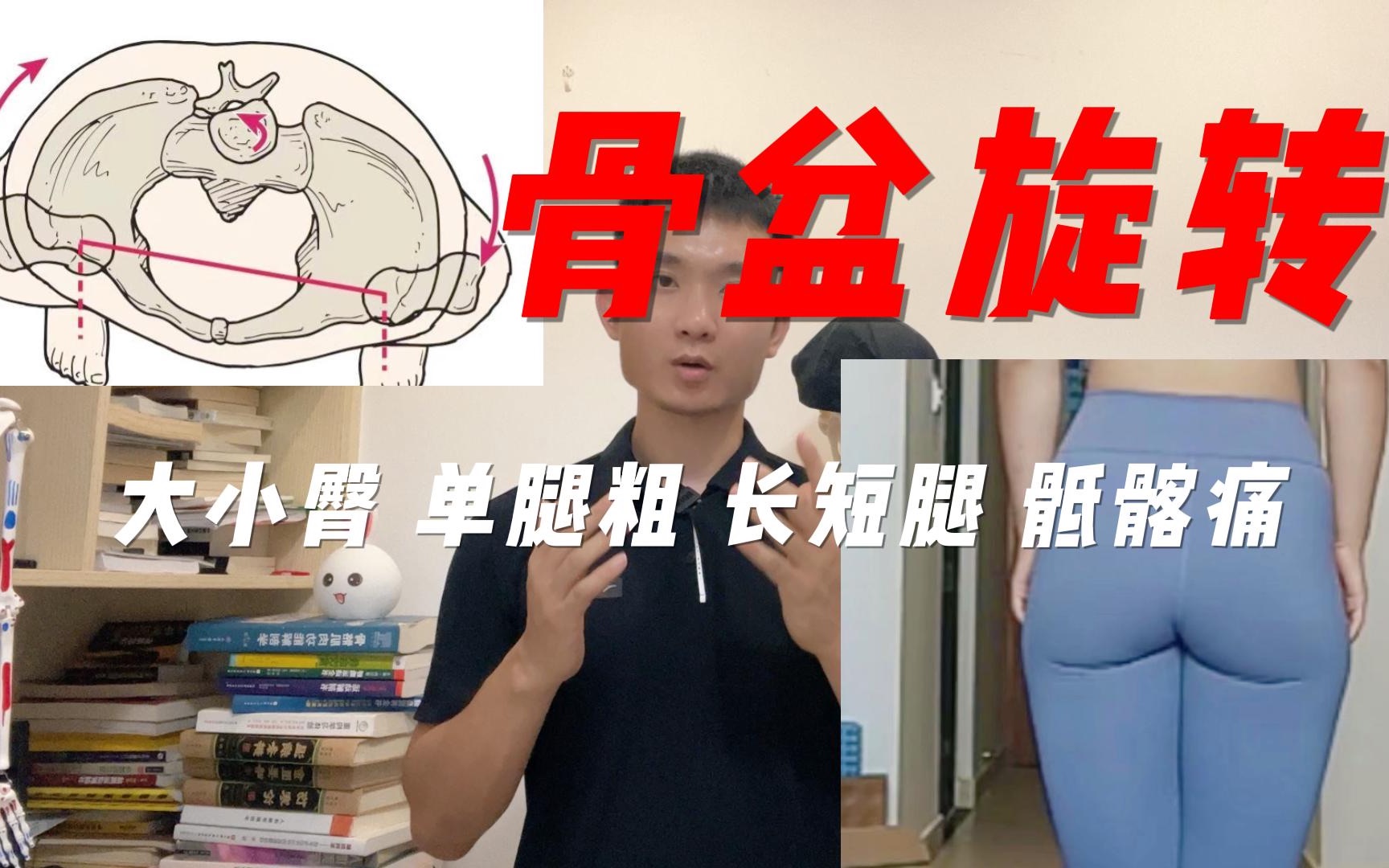 骨盆旋转:评估-矫正-发力细节,适合大小臀,长短腿,骶髂关节痛,骨盆旋转,...