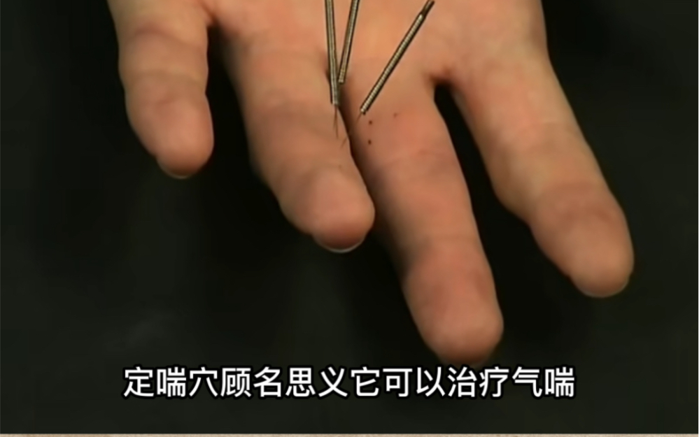 中医人体穴位分布及作用:《定喘穴》