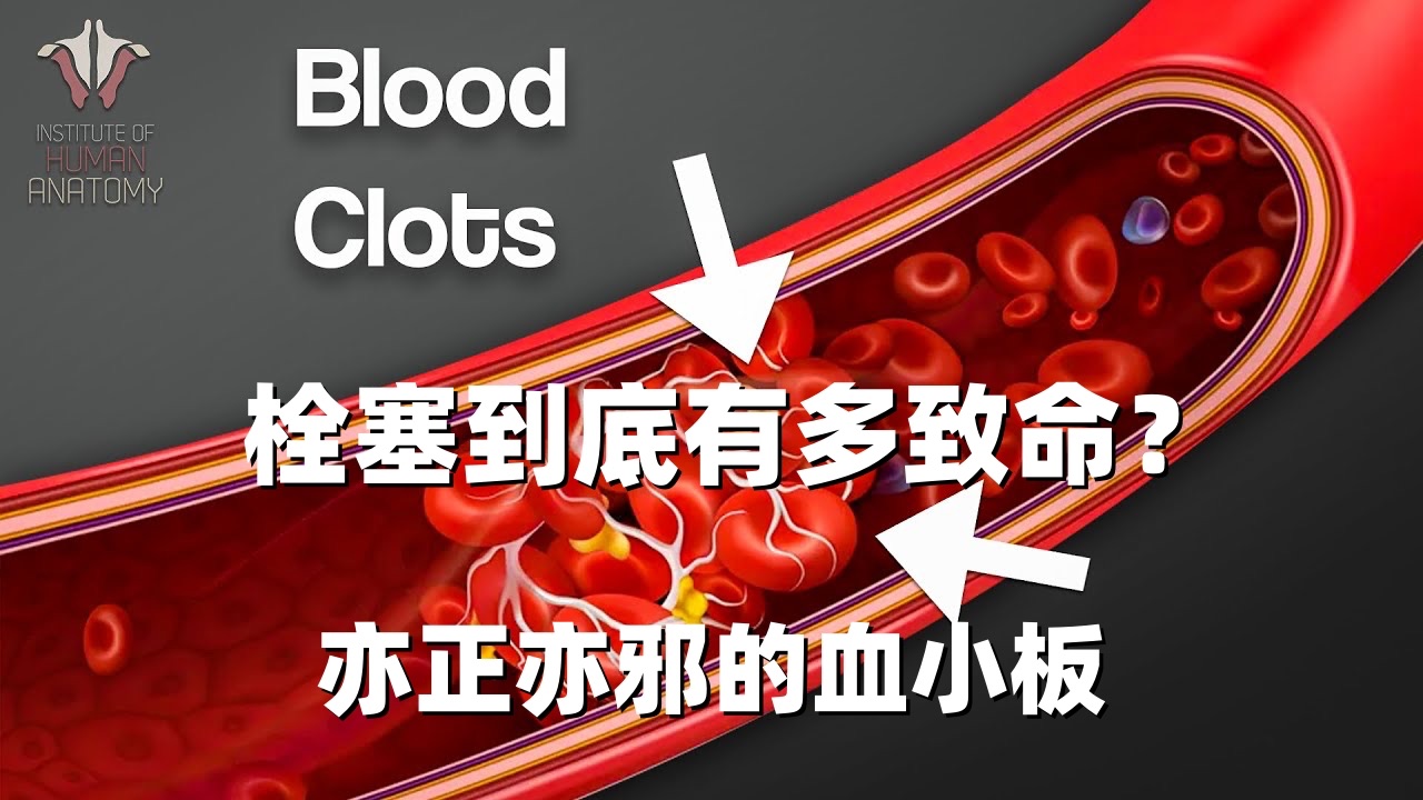 【医学科普】一条视频讲清楚所有有关血栓和栓塞的问题
