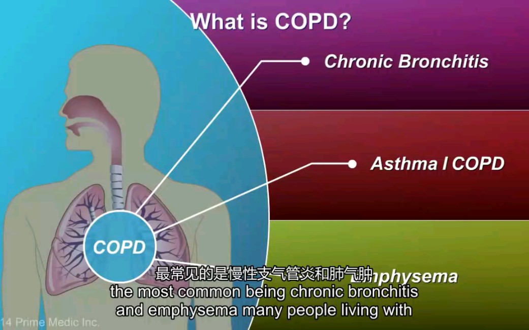【中英文双语字幕版】COPD慢性阻塞性肺疾病动画讲解