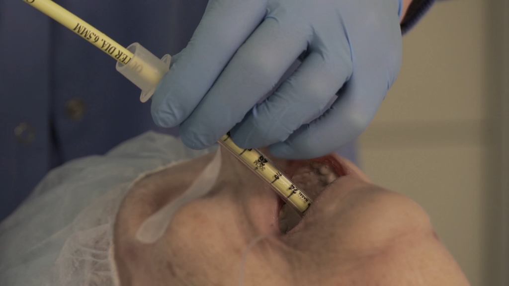 cook airway exchange tube 演示 气道交换导管