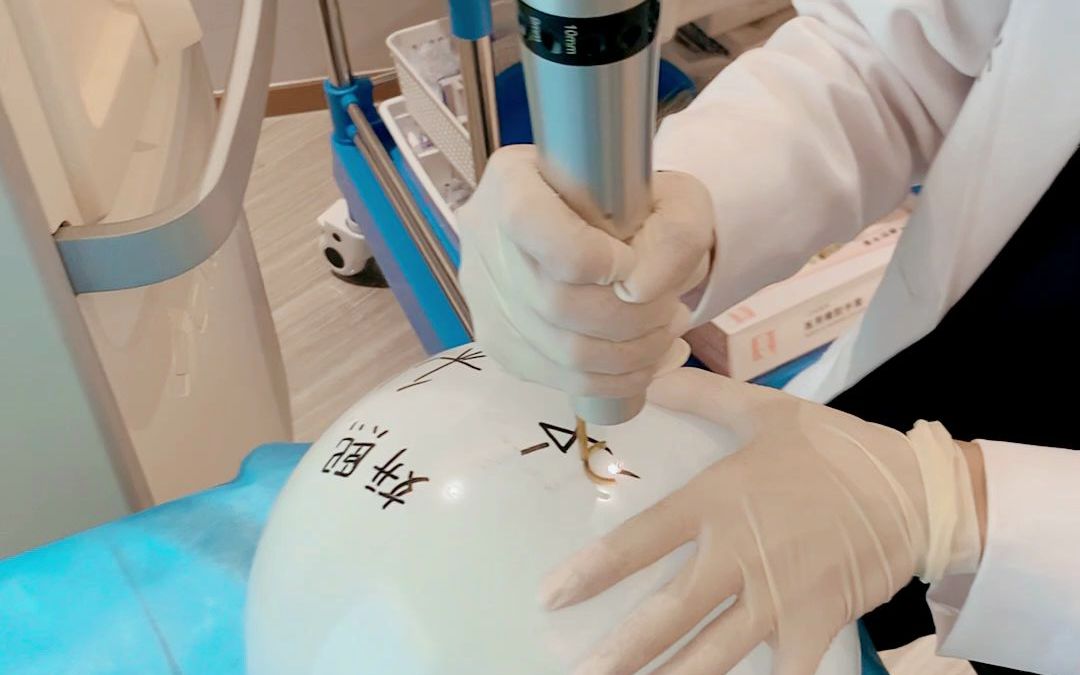 超皮秒会损伤皮肤吗