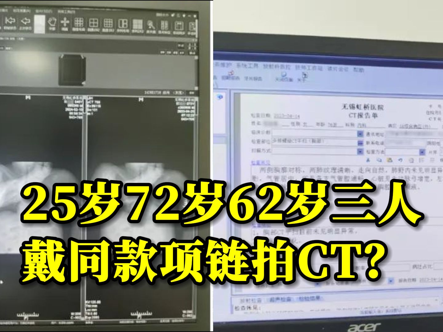 医院涉嫌骗保!25岁72岁62岁三人CT片几乎一样?无锡医保局对其行政...