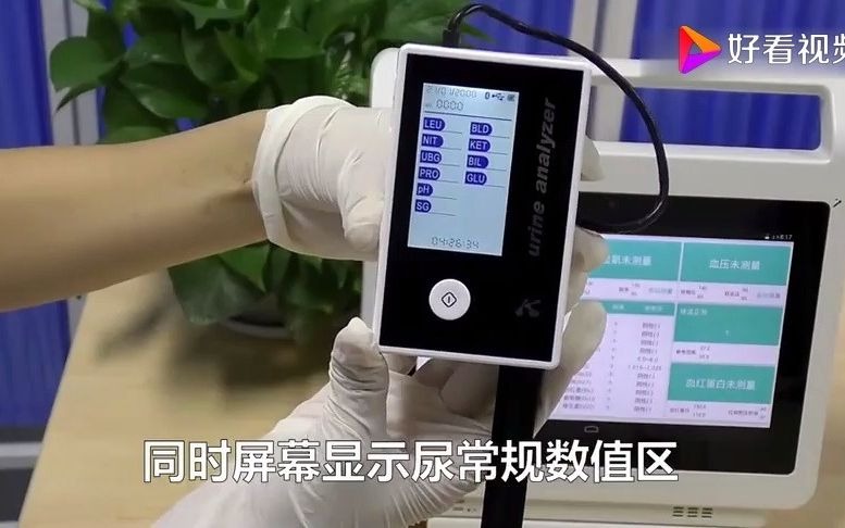 便携式尿液分析仪操作指南及保养维护