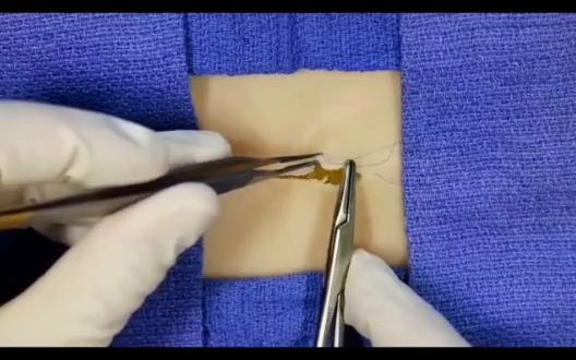 连续皮内缝合(Running subcuticular suture)