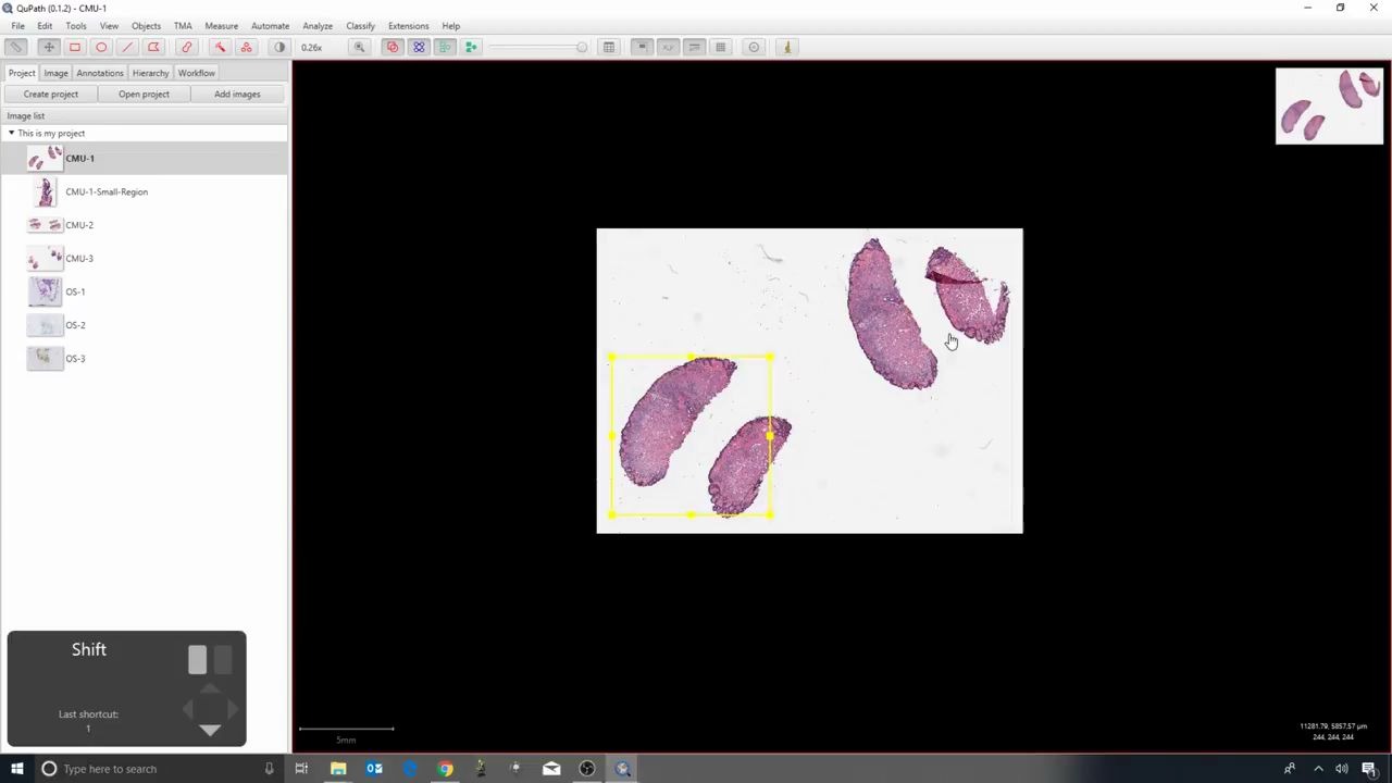 病理学切片开源处理软件QuPath官方教程 4 - Simple annotations