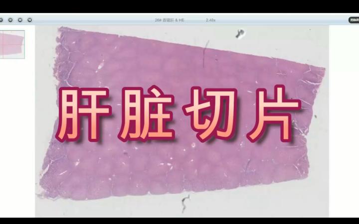 消化腺-肝-组织切片解读