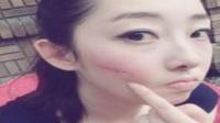 身上有疤痕太难看, 祛疤最好的方法, 几毛钱就够了!