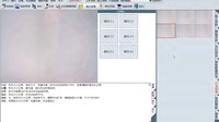 pacs-超声工作站网络版带分诊叫号系统