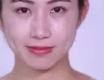 焦守廷上传任脉《承浆穴》