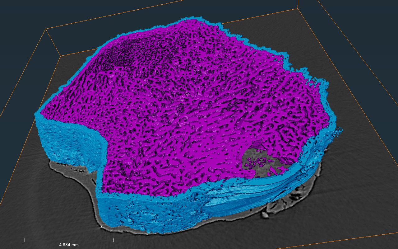 【Amira小Demo】基于CT图像计算骨分析参数,如骨体积BV、组织...