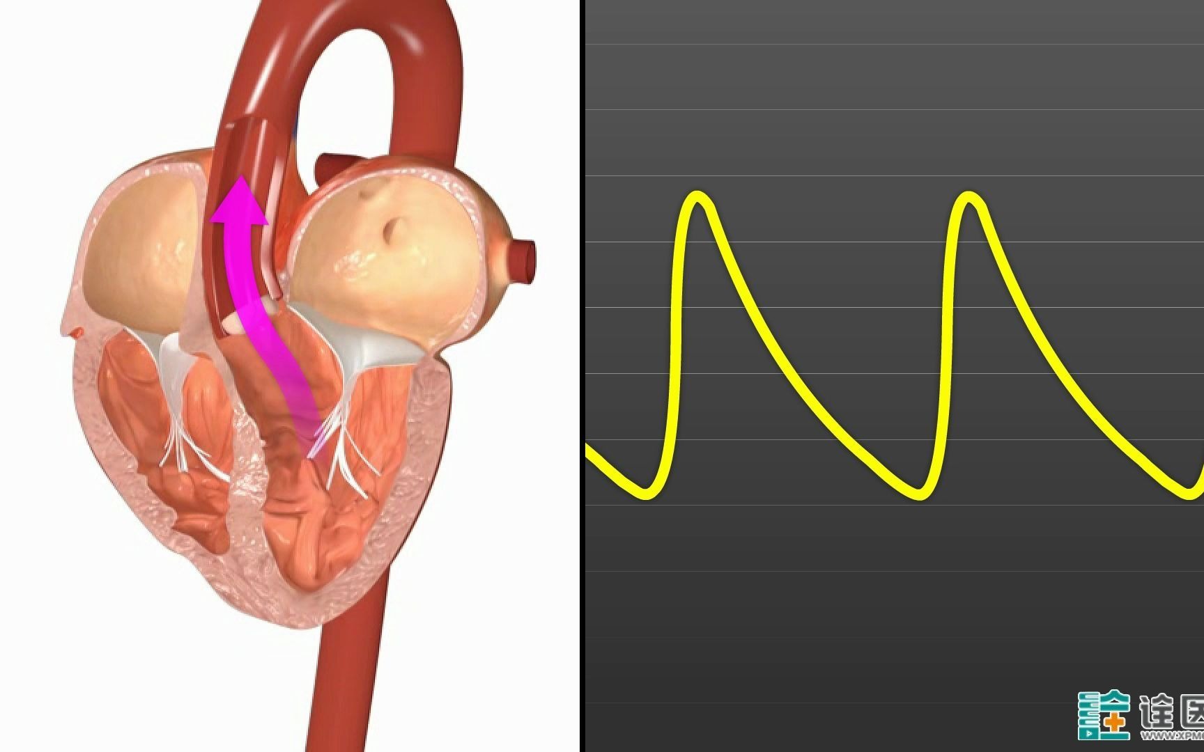 血压高了会有什么表现?