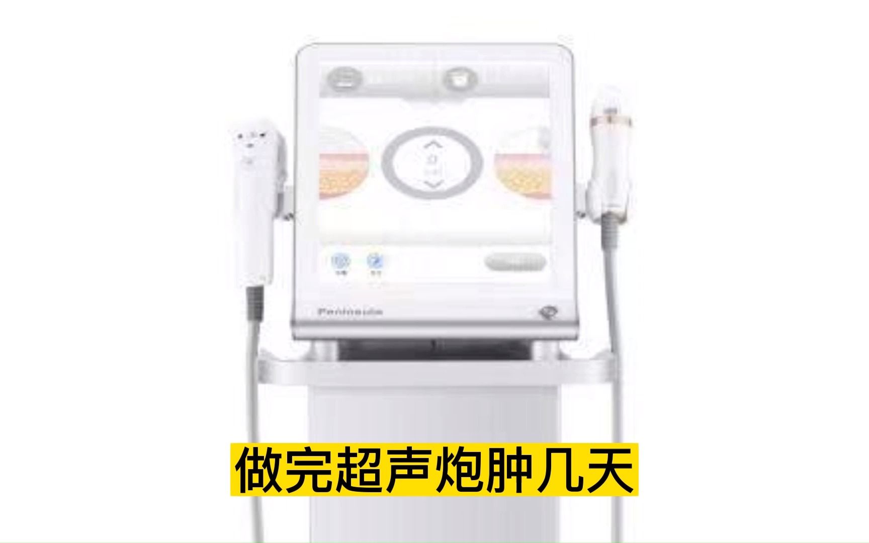 做完超声炮肿几天