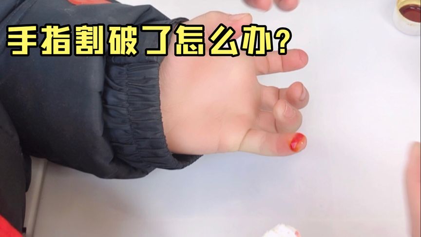 孩子贪玩手指被刀割伤,不敢去医院怕被缝针,可止不住血该怎么办?