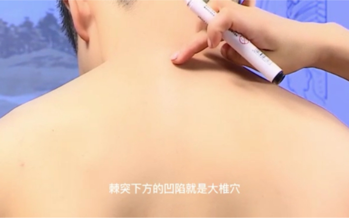 取穴位视频2(大椎穴)