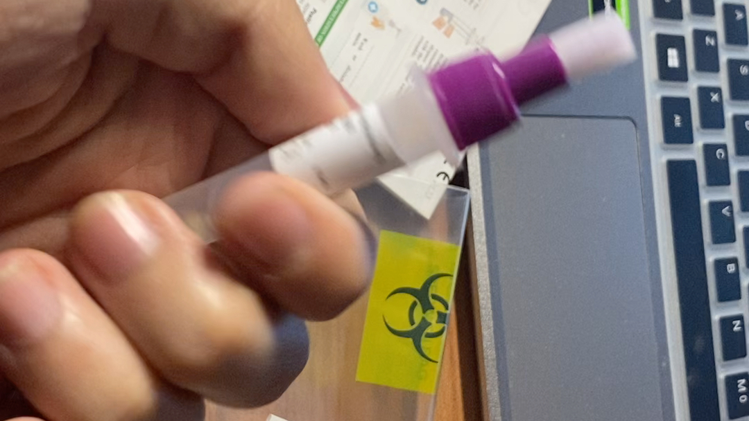 开箱一个学校发的核酸检测试剂盒