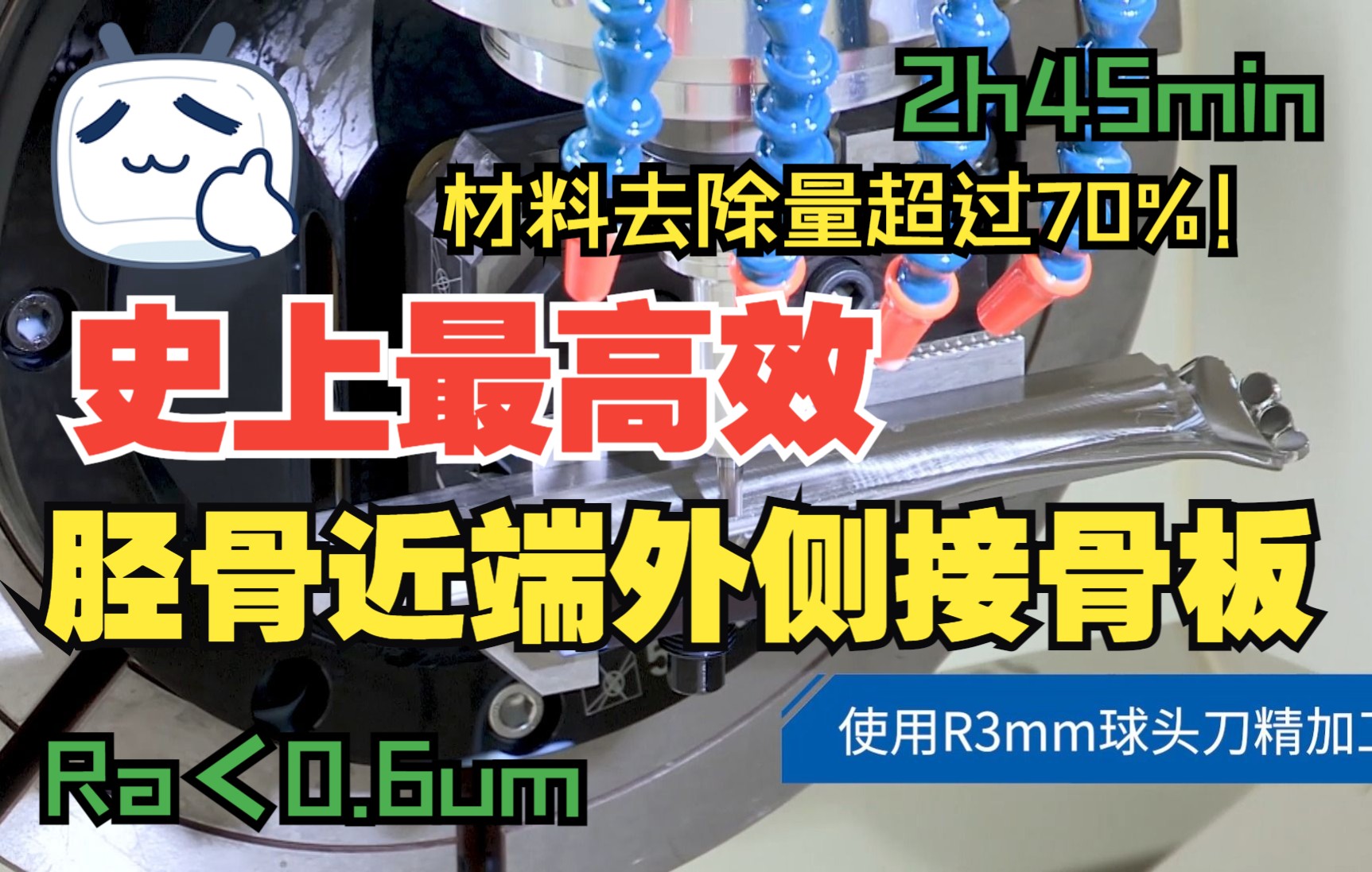 医疗器械系列-3:北京精雕骨科植入类零件加工解决方案