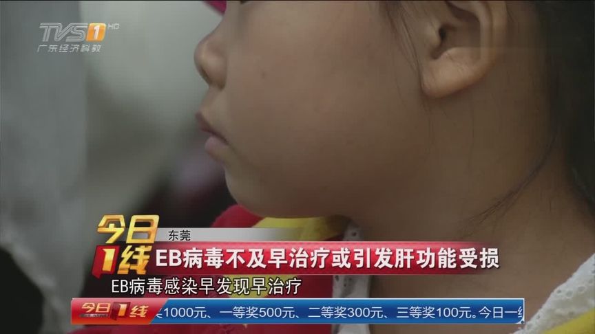 5岁男童感染EB病毒 高烧不退脸变形