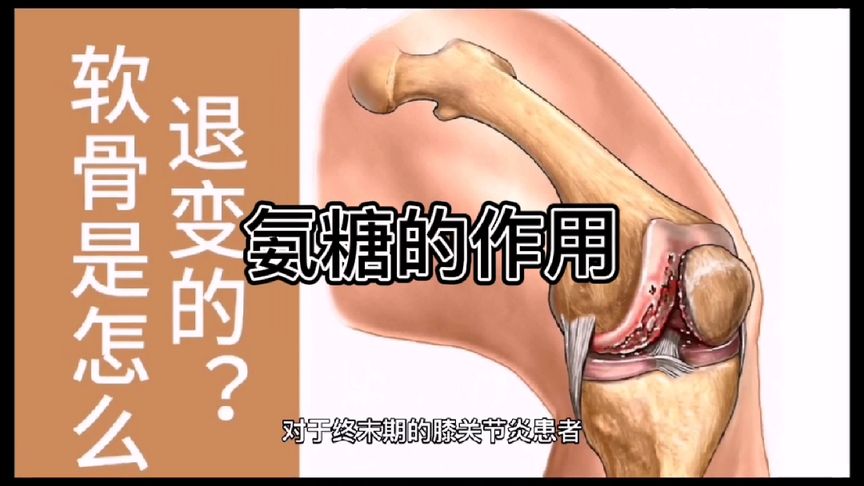 氨糖的作用
