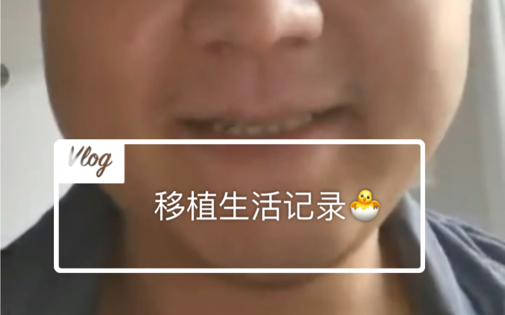 嗜血细胞综合症,造血干细胞移植进仓生活记录