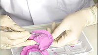 口腔医学视频-全口义齿取模