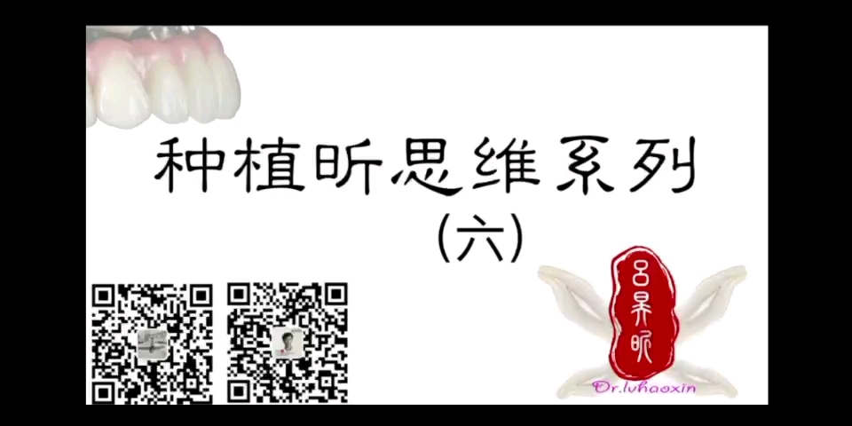 6.种植体的连接设计