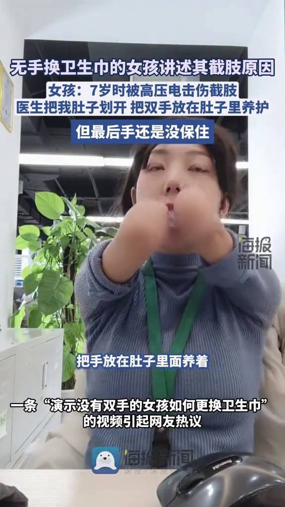 ...其截肢原因:7岁时被高压电击伤。#无手女孩 #残疾人正能量 #卫生巾