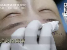 注射瘦腿课程肉毒素美容教程视频