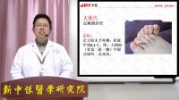 中医穴位详解——大敦穴