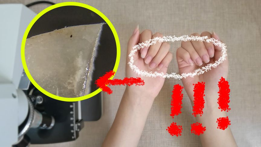 1克指甲盖垢中,有40亿个细菌,来看显微镜下的指甲盖是啥样