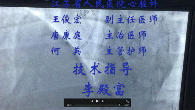 医学小视频 经桡动脉行冠状动脉造影