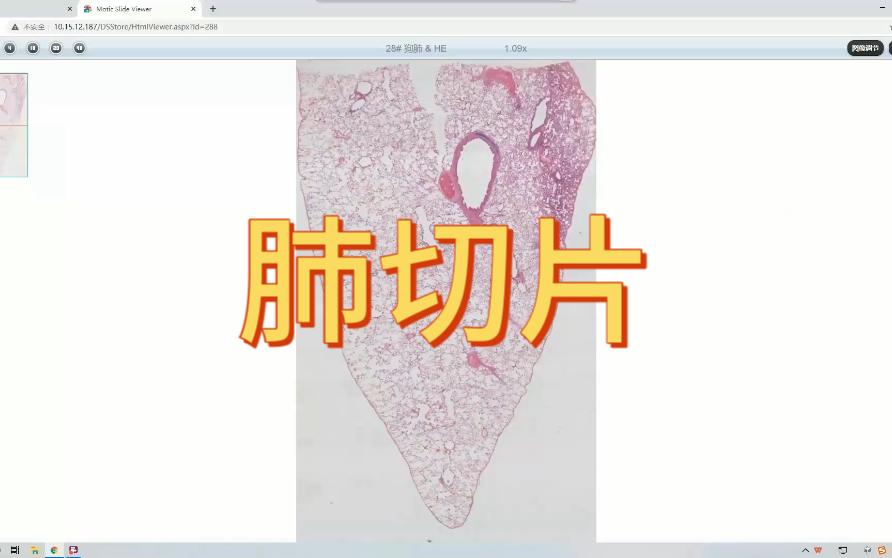 呼吸-肺-组织切片解读