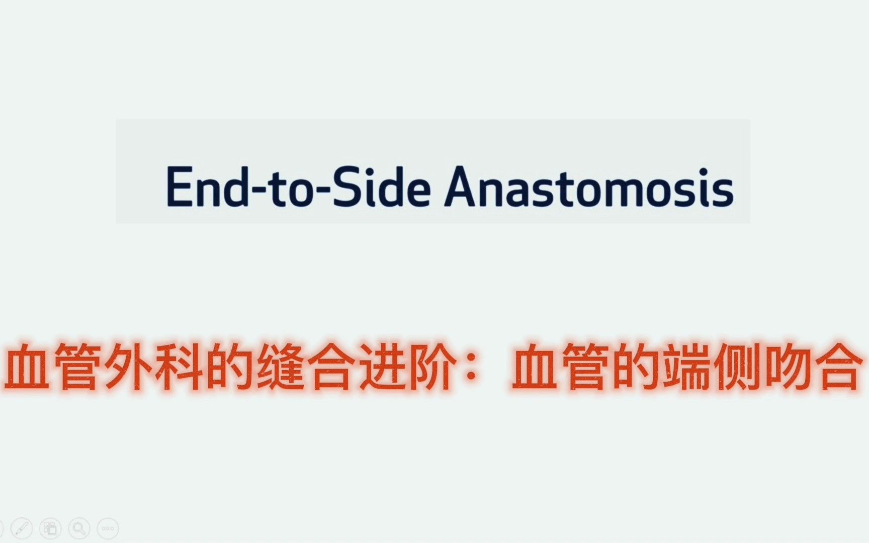 血管外科的缝合进阶:血管的端侧吻合