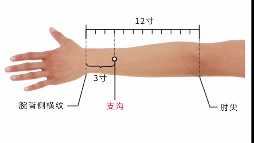 治疗便秘的特效穴:支沟穴