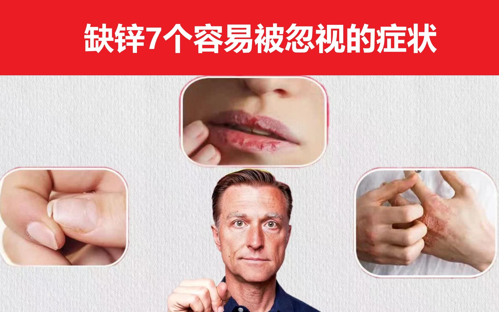 缺锌7个容易被忽视的症状