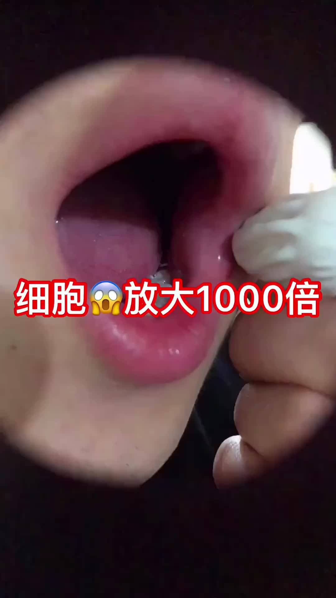 显微镜放大口腔表皮细胞震惊了。