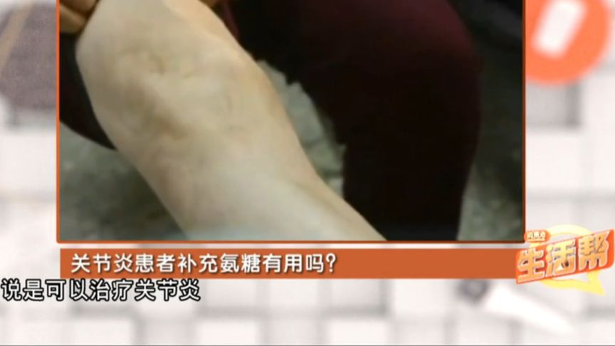 关节炎患者补充氨糖软骨素有用吗?听听专家怎么说!