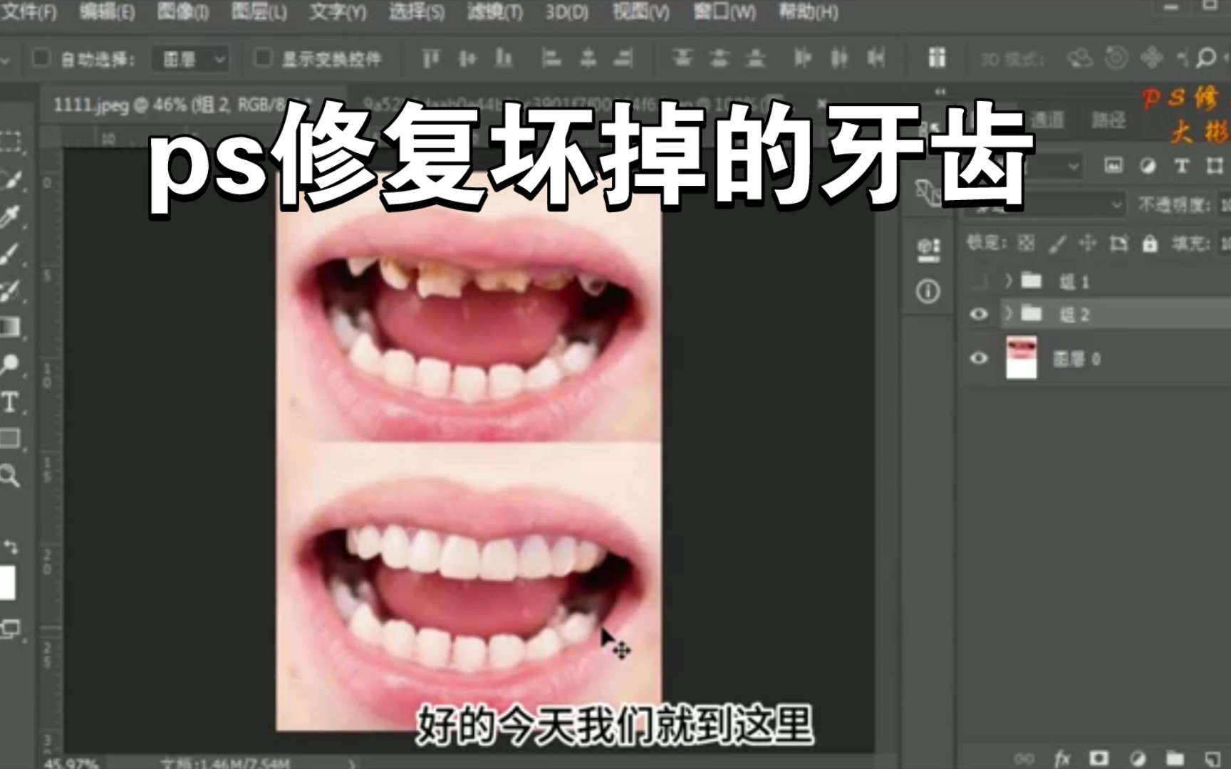 ps修复坏掉的牙齿