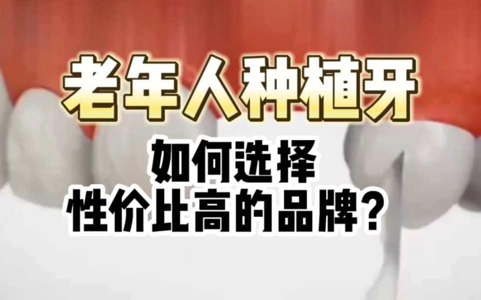 老年人种植牙,如何选择性价比高的品牌?