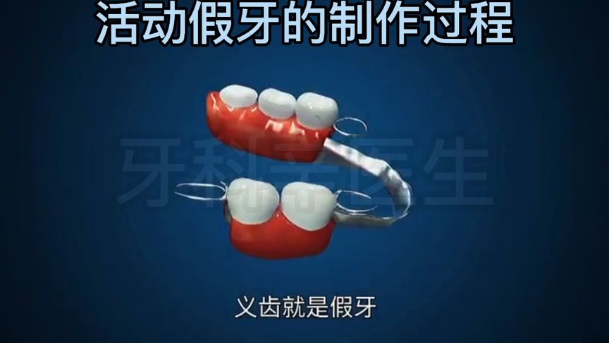 辛医生牙科小知识:活动假牙制作过程大解析。