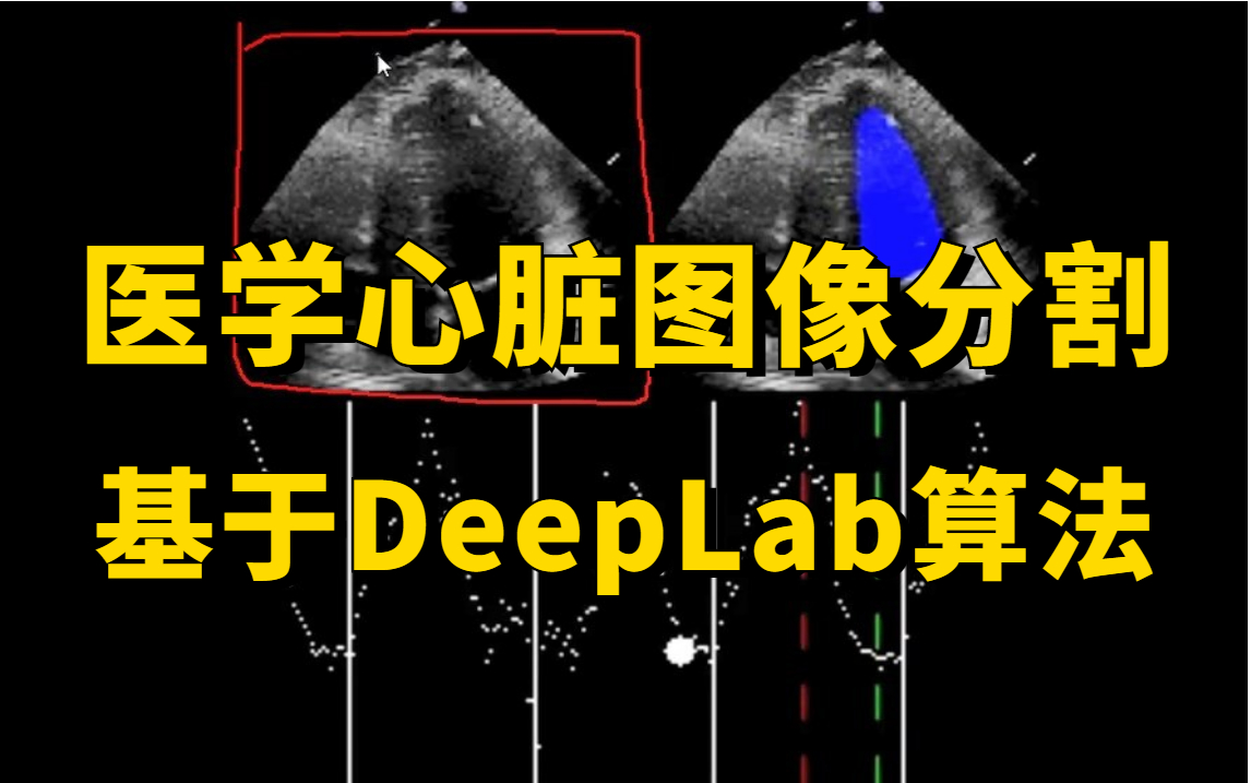医学图像分割实战:基于DeepLab算法实现医学心脏图像分割,原理详解+...