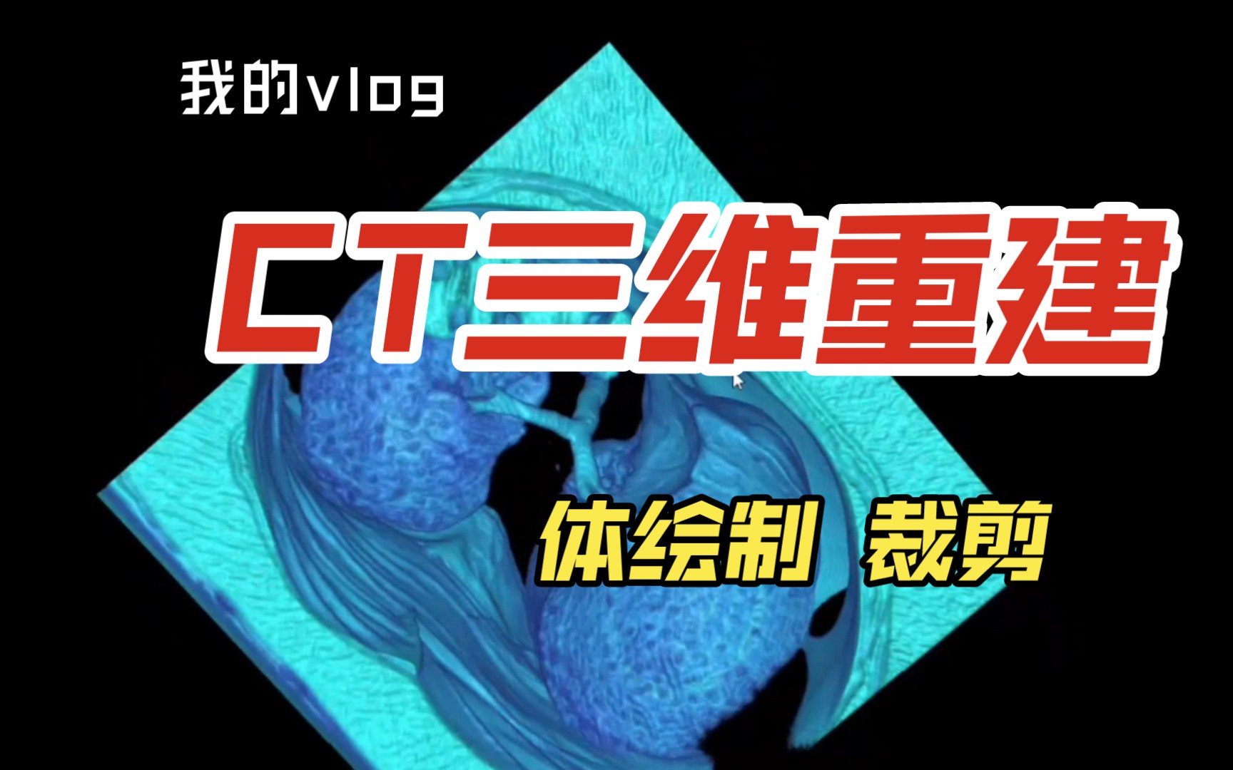 Python PyQt 医学图像 趣味重建 CT三维重建 肺部三维重建 VTK