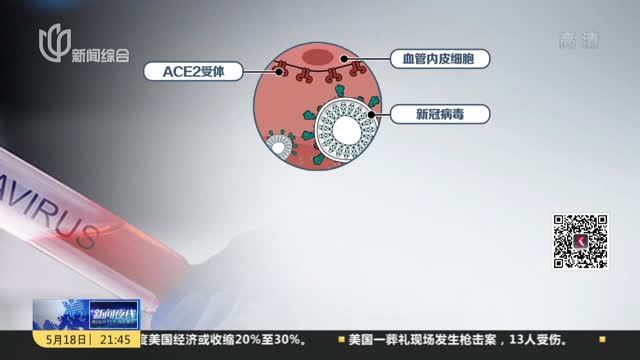 中国团队发现可阻断新冠病毒感染的人源单克隆抗体