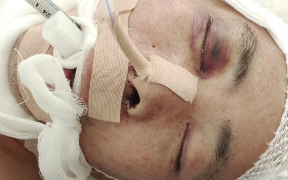 工地出现安全事故,老板推卸责任跑路?玩消失?我一定会替我父亲拿回...