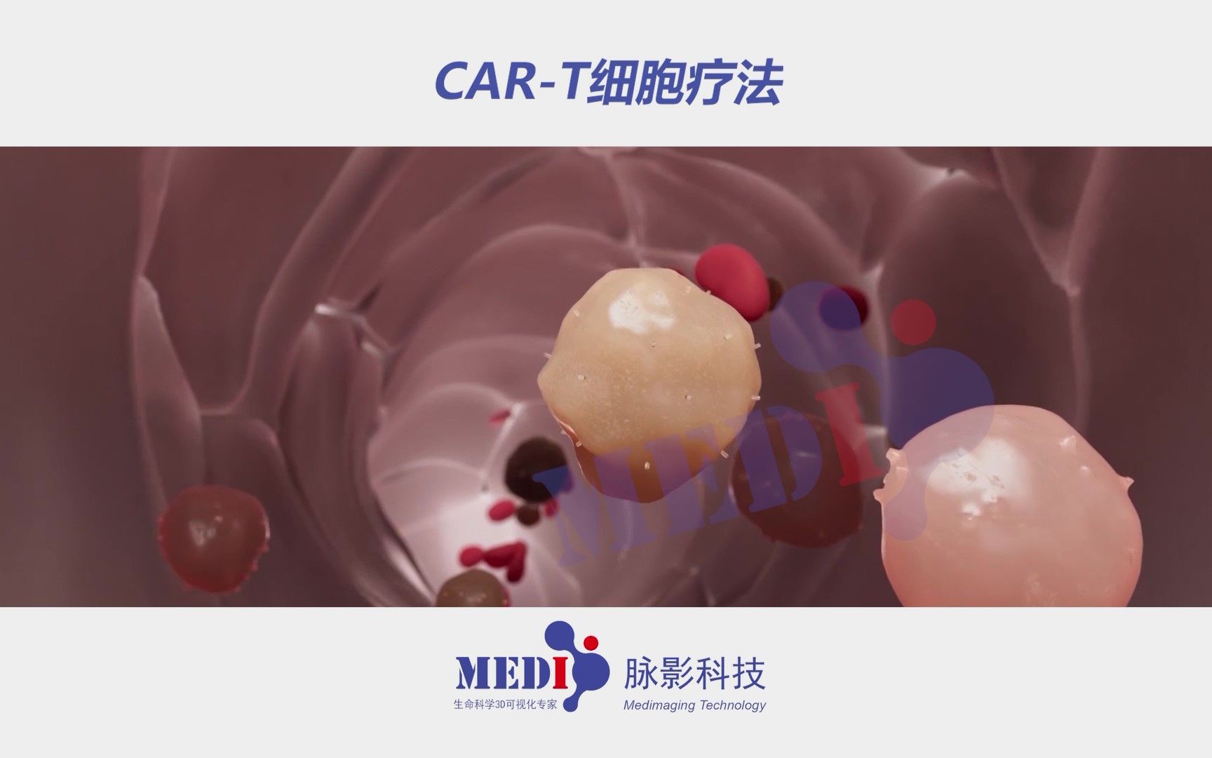 CAR-T细胞疗法