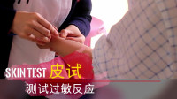医院里那些常规检查 皮试:测试过敏反应
