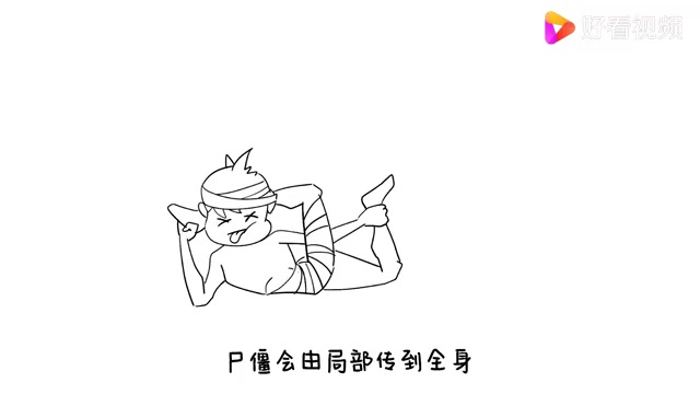 人死亡后的72小时内,尸体会发生什么变化?
