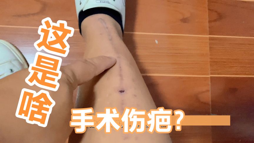 贵州小伙骑车逆行,发生交通事故,光医自己就要2万医药费!